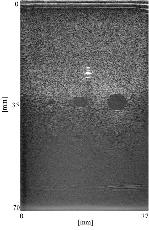 B Mode Scan A And Frequency Mapping B Of The Tissue Phantom Download Scientific Diagram