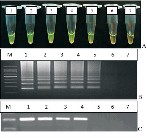 Figure 1 From Rapid Detection Of Salmonella Typhi By Loop Mediated