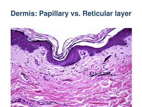 Reticular Layer