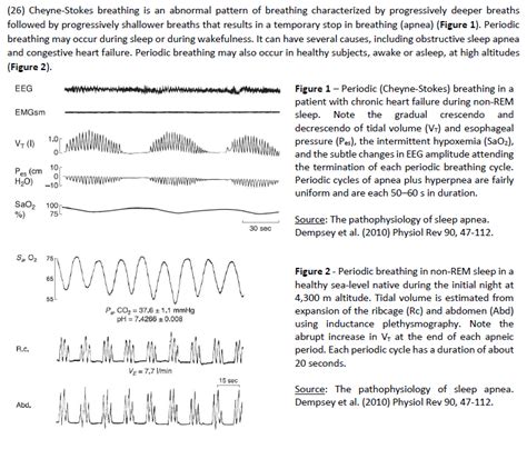 Cheyne Stokes Breathing Pattern