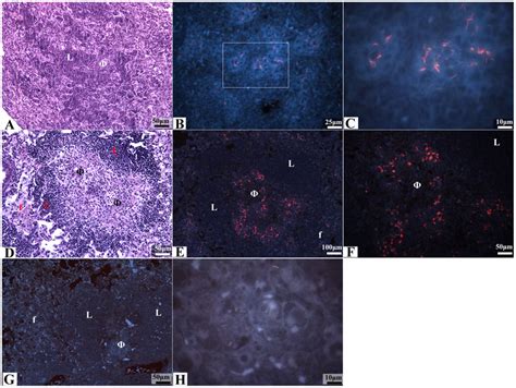 Intracellular M Tuberculosis Bacilli In Lungs From Download Scientific Diagram