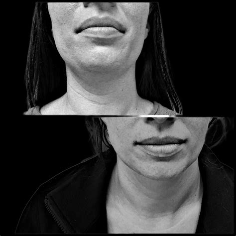 Dr Timothy Treece Drtreece • Instagram Photos And Videos