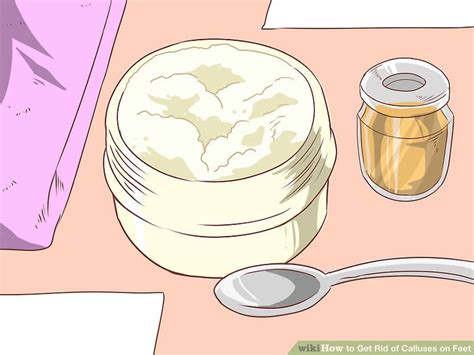 Ways To Get Rid Of Calluses On Feet WikiHow