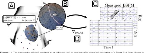 Digital Twinning Of Cardiac Electrophysiology Models From The Surface Ecg A Geodesic