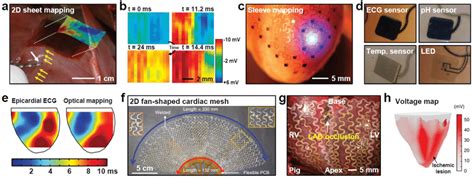 Soft Epicardial Mapping Devices A Optical Image Of A Flexible Download Scientific Diagram