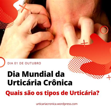 Dia Mundial Da Urticária Crônica Quais São Os Tipos De Urticária
