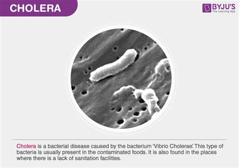 Pathogen Of The Month Vibrio Cholerae The Causative Agent Of Cholera