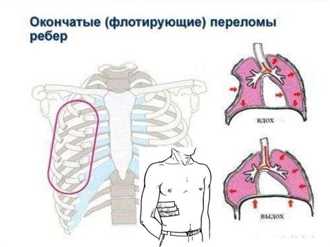 Захворювання та ушкодження грудної клітки та органів грудної порожнини презентация онлайн