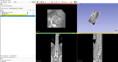 How To Create An Image Slice And Add Observer Support 3d Slicer