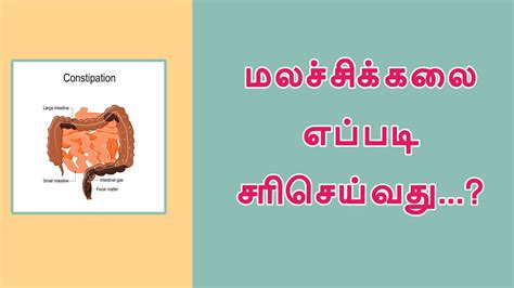 மலசிக்கலை எப்படி சரி செய்வது Youtube