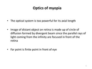 Myopia Pptx