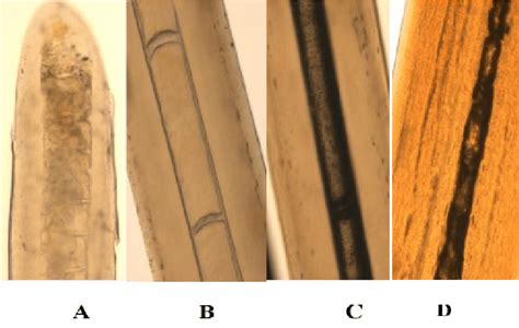 A Medullary Pattern In Proximal Part Of Hair B And C Medullary Pattern