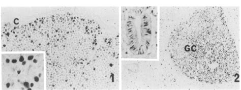 Figure 1 From Double Immunoenzymatic Detection Of Surface Phenotype Of Proliferating Lymphocytes