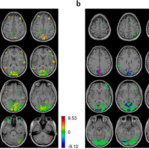 Optimized Latency In A Native Brain A Latency Map For Voxels From Download Scientific