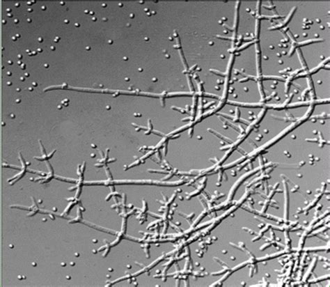 Nueva Regulación Para El Hongo Trichoderma Que Actúa A La Vez Como