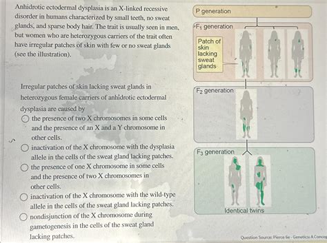 Solved Anhidrotic Ectodermal Dysplasia Is An X Linked
