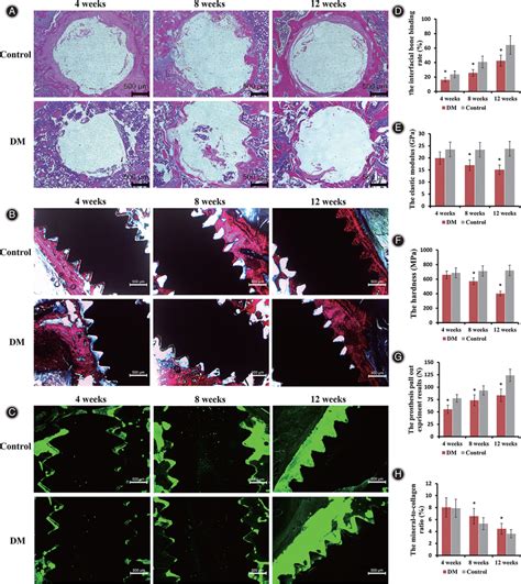 Histological And Histomorphometric Analysis Micro‐indentation Download Scientific Diagram Histological And Histomorphometric Analysis Micro‐indentation Download Scientific Diagram