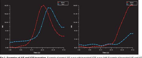 Figure 3 From Effect Of Extended Ct Perfusion Acquisition Time On Ischemic Core And Penumbra