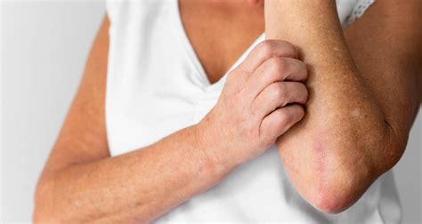 Sardas Brancas O Que é Sintomas Causas E Tratamento Mundoboaforma