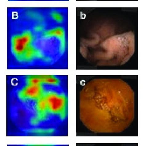 Graph Visualizing The Results Of Gi Organ Classification Ai Model Over Download Scientific