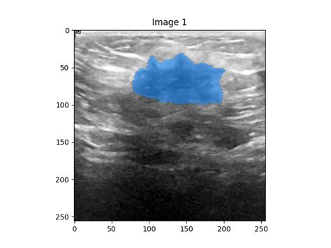 Deploy Segment Anything Model SAM For Inference On Amazon SageMaker Union Ai