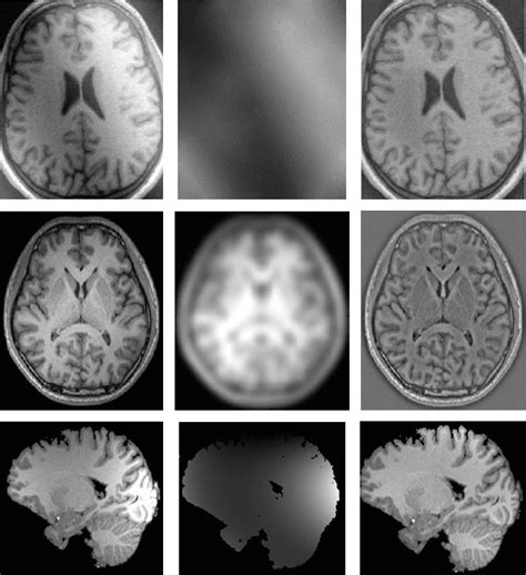 Figure 2 From A New Kernel Based Fuzzy Level Set Method For Automated