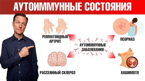 Аутоиммунные заболевания: 7 причин, о которых вы не знали🙌 - YouTube