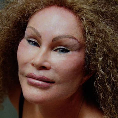 Celebrity Died Of Plastic Surgery 60 Photos Moonagedaydreamfilm