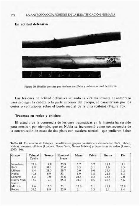 Traumas 177 Frontal Pres