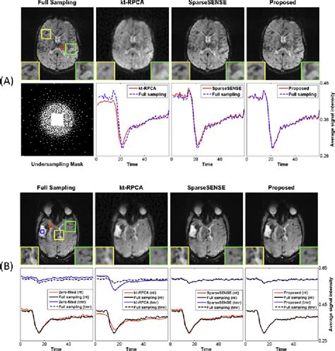 Figure 1 From A Robust Reconstruction Method For Quantitative Perfusion Mri Application To