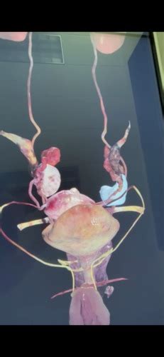 LAB QUIZ WEEK 4 Flashcards Quizlet