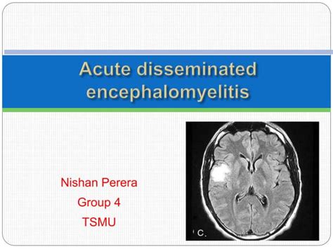 Acute Disseminated Encephalomyelitis Pptx