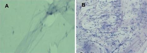 A Sparse Density B Dense Density Download Scientific Diagram