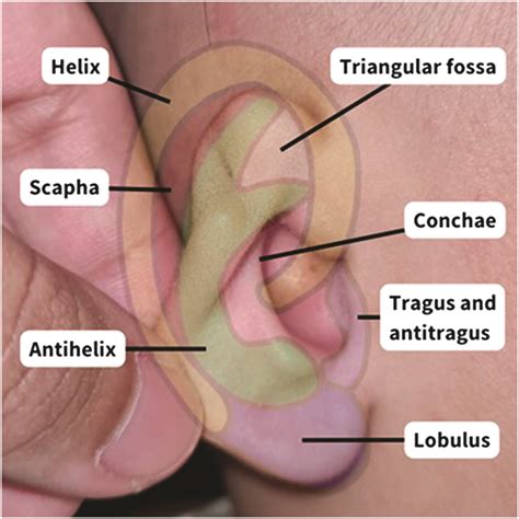 Correlation Of Grading And Number Of Ear Subunits With Auditory