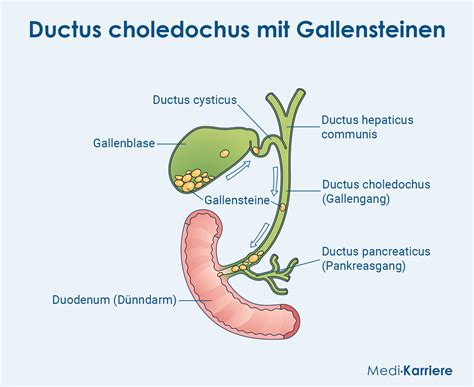 Ductus Choledochus Anatomie Verlauf Und Klinik