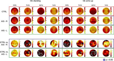 topographic maps of relative power in delta [1 4] hz theta