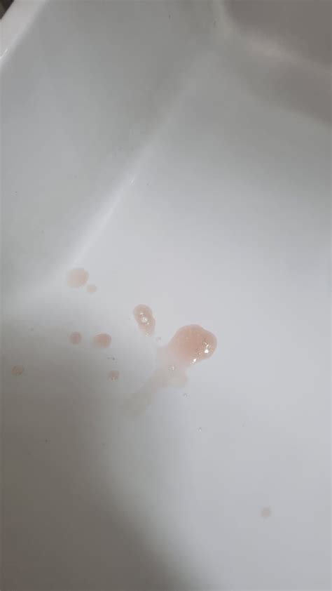 정액이 빨간색입니다 지식in