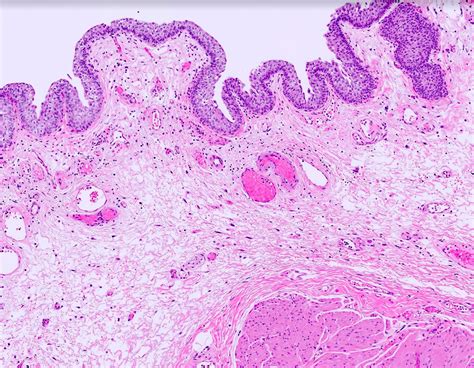 Pathology Outlines Histology