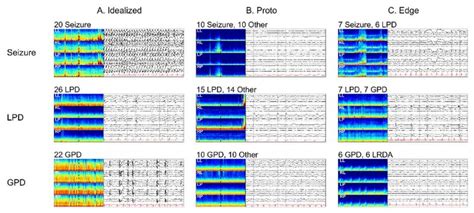 Examples Of Labeled Spectrograms Download Scientific Diagram