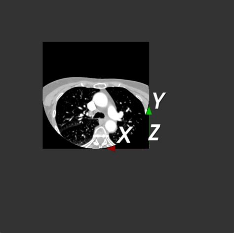 归一化平面和像素坐标系