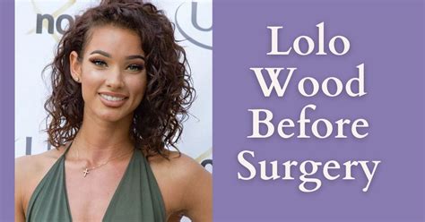 Lolo Wood Before Surgery Exploring Her Natural Beauty