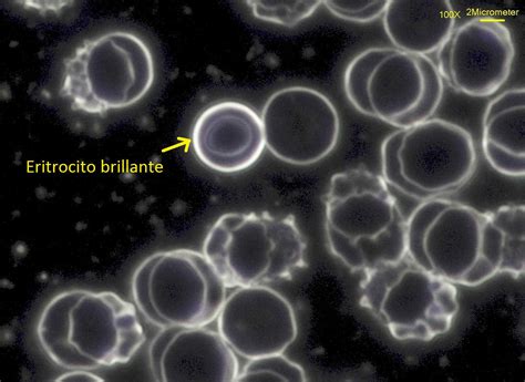 Eritrocito Brillante Con Microscopio De Campo Oscuro Cursos De Medicina Natural