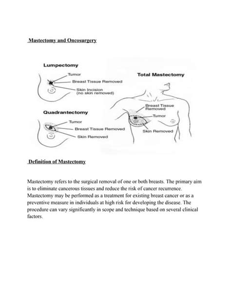 Toilet Mastectomy For Advanced Breast Cancer Ppt
