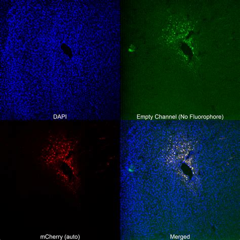 481 Questions With Answers In Dapi Science Topic