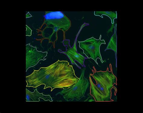 Challenging Segmentation With Cellpose Need Help Image Analysis
