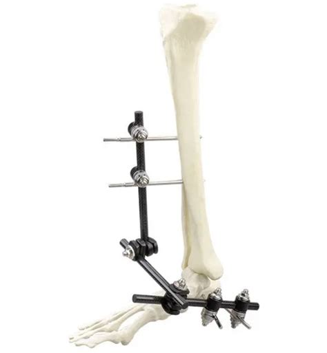 Φ11 0 Series External Fixation Fixator Ankle Bridge Frame Imc Supplier