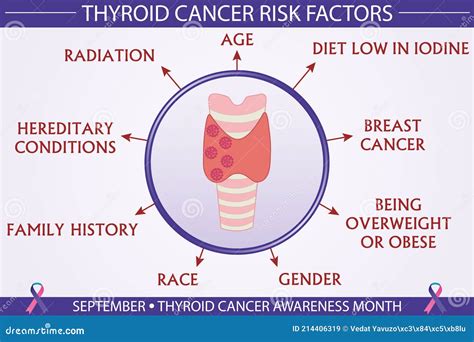 Thyroid Cancer Disease Risk Factors Infographic Vector Illustration Stock Vector Illustration