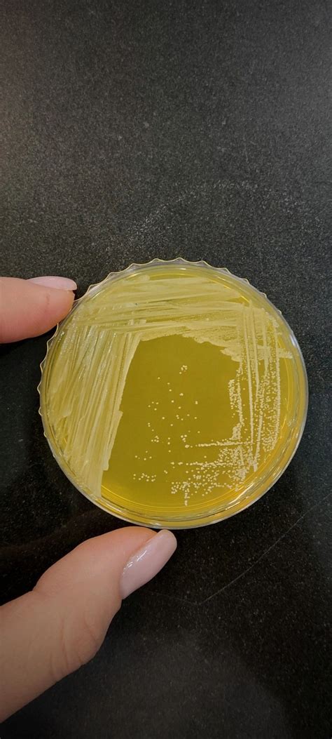 Hanna Alizadeh On Linkedin Staphylococcus Aureus On Msa Beautiful Gold Culture 🌟