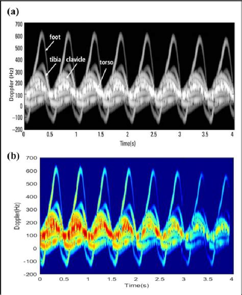 Figure 1 From Human And Bird Detection And Classification Based On Doppler Radar Spectrograms