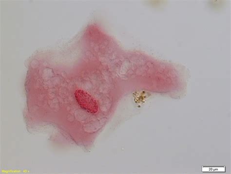 What Is The Difference Between Endoplasm And Ectoplasm Pediaa Com